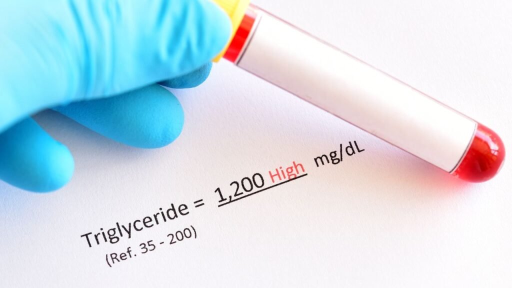 Jammu & Kashmir Shock Report: 50% Of Children Have High Triglycerides ...